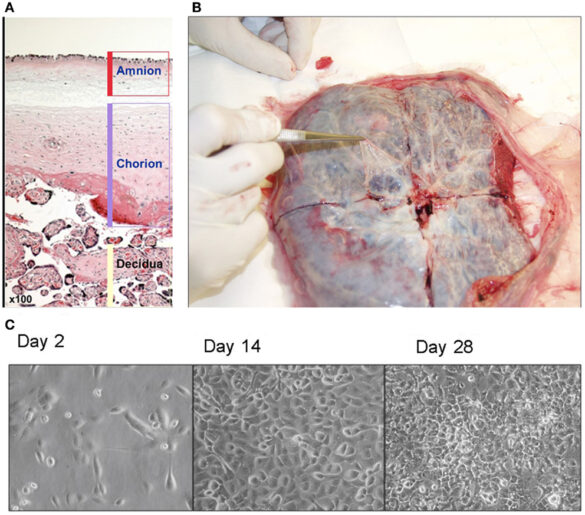 Amniotic Cells - SciTechPedia - Encyclopedia of Science and Technology