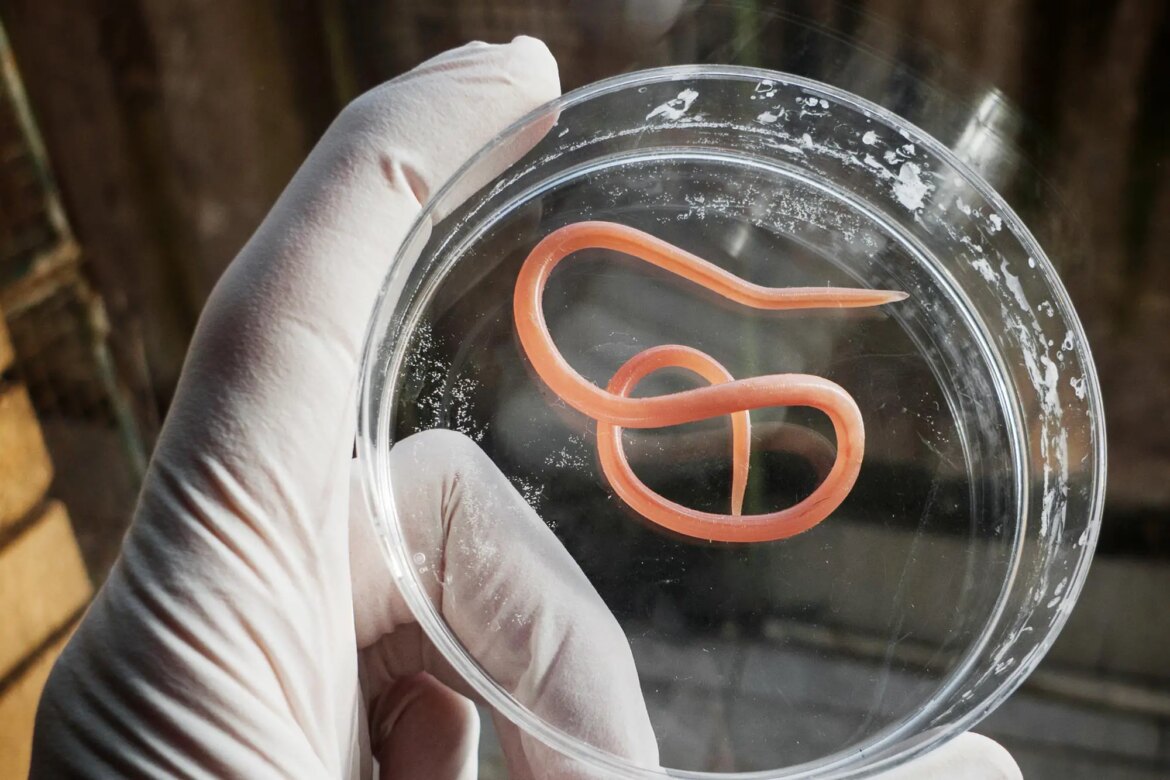 Surgical Extraction of Living 3.1-inch Parasitic Roundworm from ...